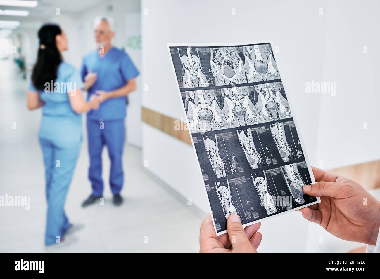 Ct scan abdomen hi-res stock photography and images - Alamy Ct scan abdomen hi-res stock photography and images - Alamy