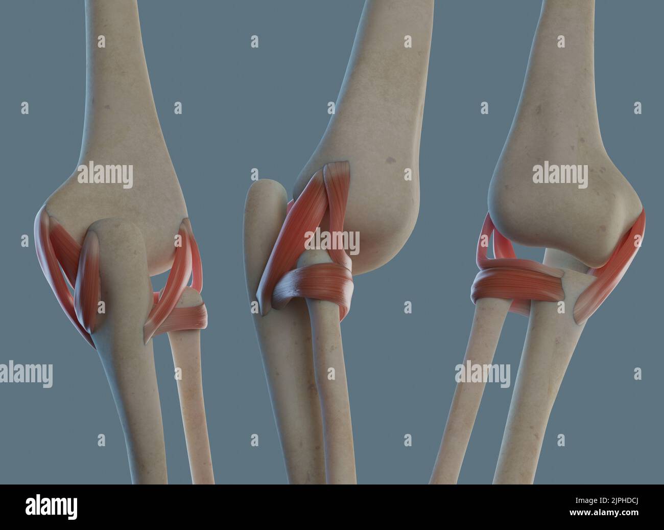 Elbow joint anatomy, including ligaments and bones. Multiple angles ...