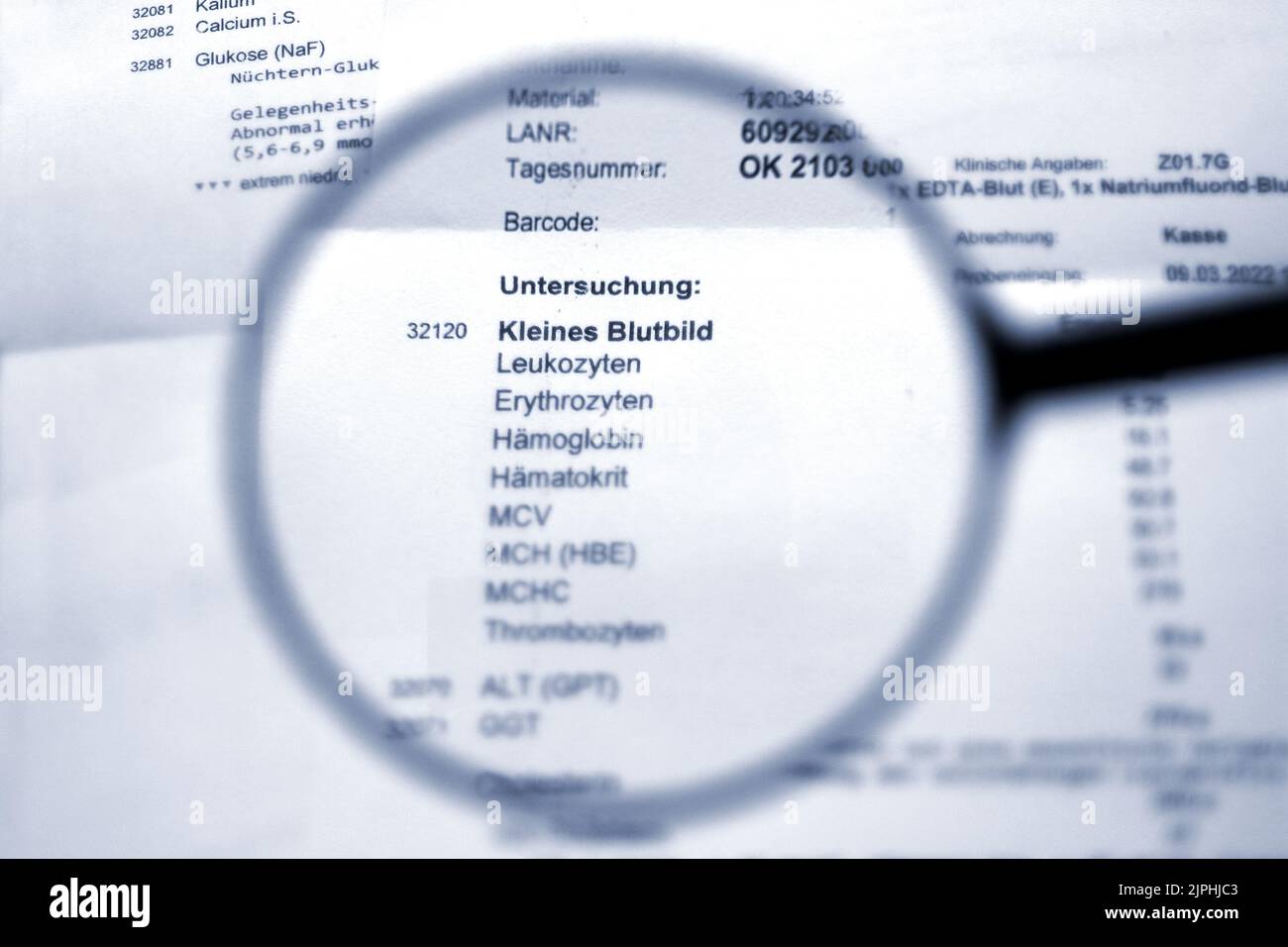 blood, kleines blutbild, blutwerte, laborwerte, bloods Stock Photo - Alamy
