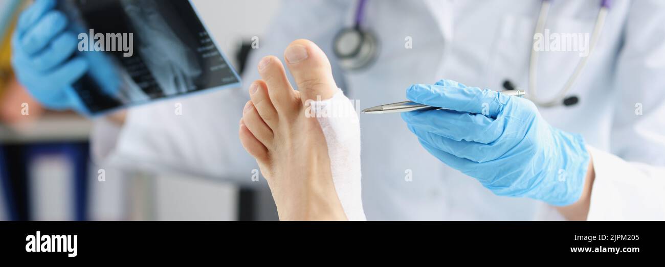 Doctor examines x-ray of dislocated leg of patient lies on table Stock ...