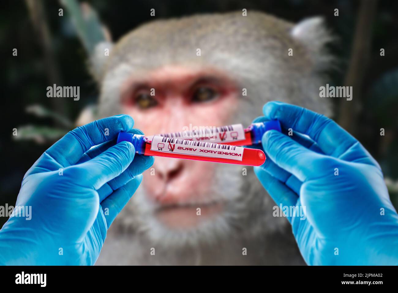 Two flasks with blood tests for the monkey pox virus against the ...