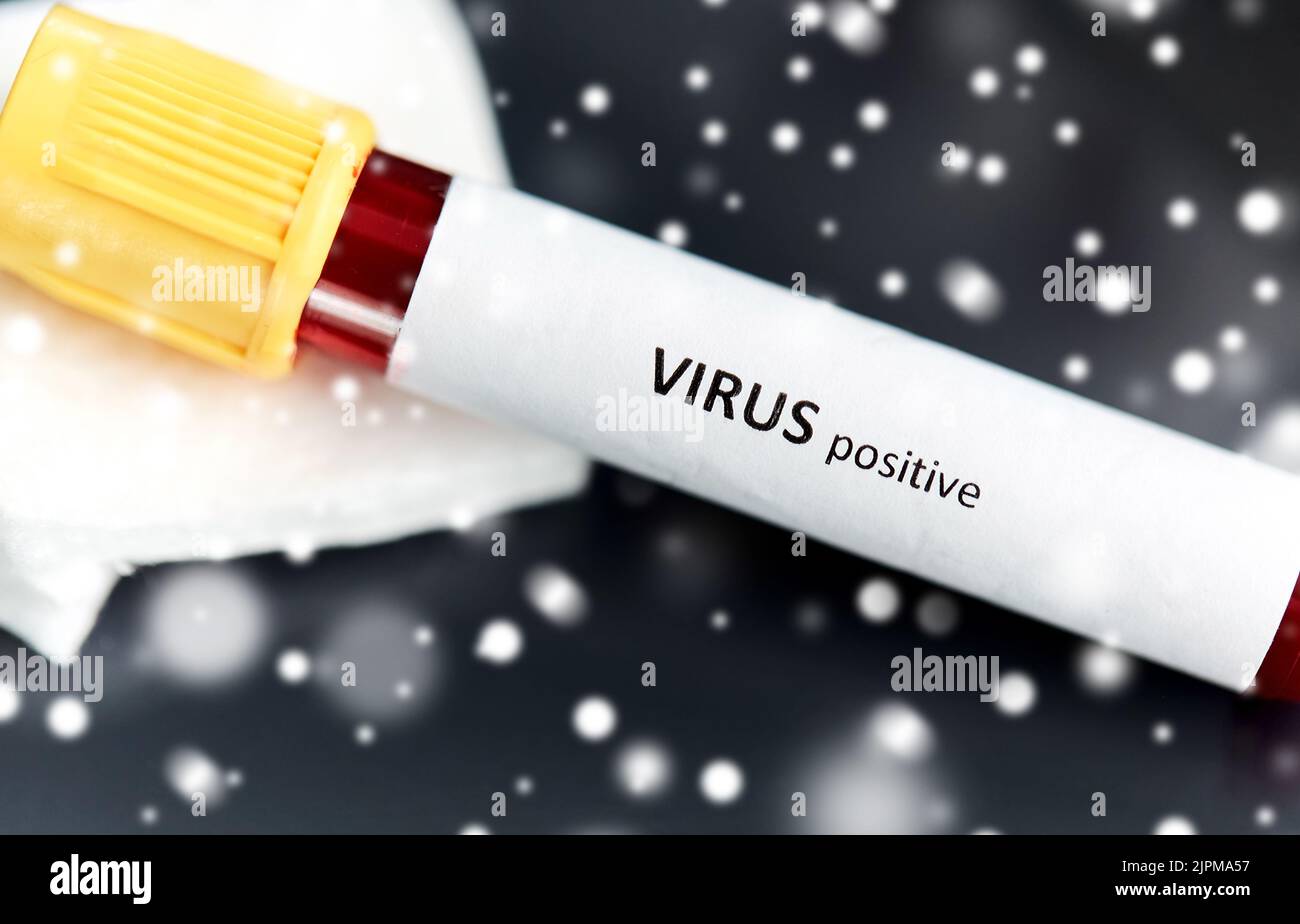 beaker with virus blood test at laboratory Stock Photo - Alamy