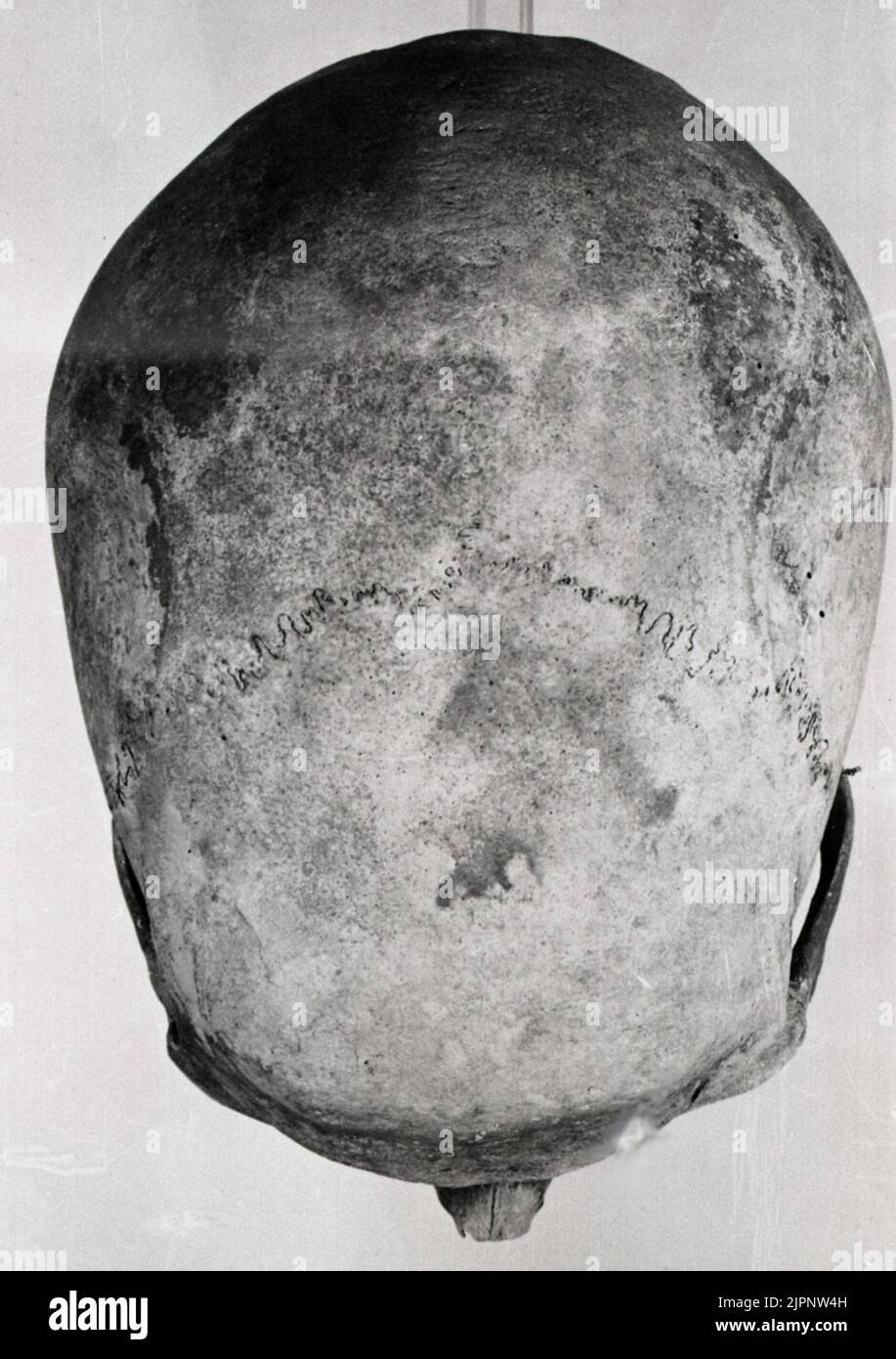 Grave 31. Skeleton IV. Skull seen from above. Grav 31. Skelett IV ...