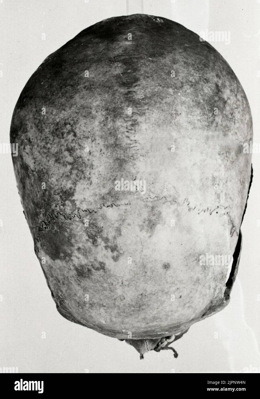 Grave 31. Skeleton II. Skull from above. Grav 31. Skelett II. Kranium ...