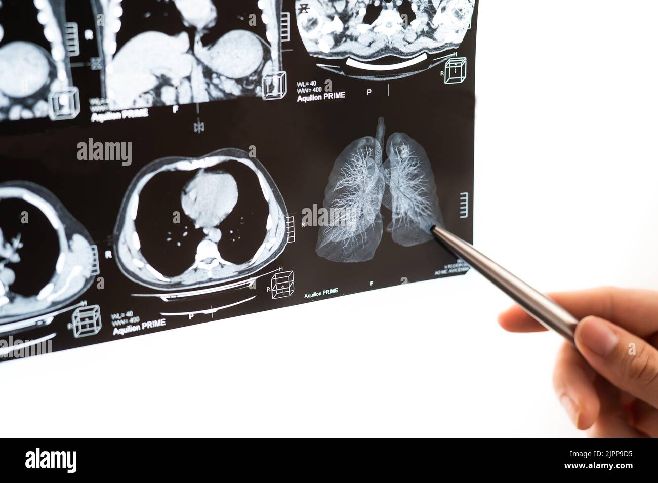 A female doctor examines an MRI scan of the internal organs Stock Photo ...