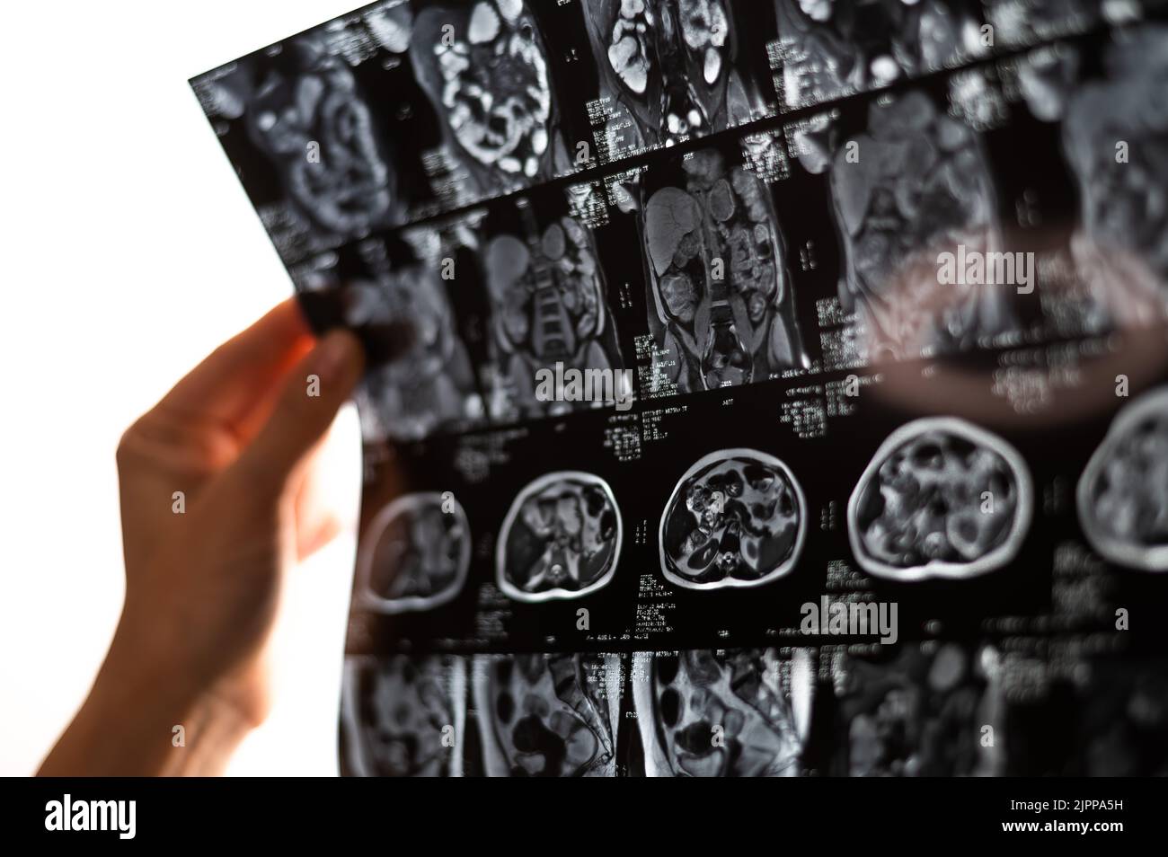 A female doctor examines an MRI scan of the internal organs. Abdomen ...
