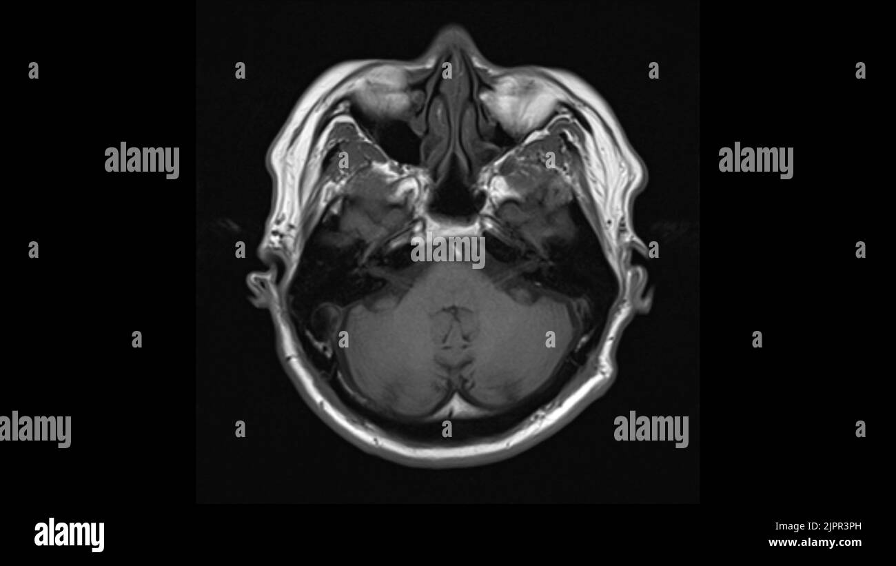 Mri scan series hi-res stock photography and images - Alamy