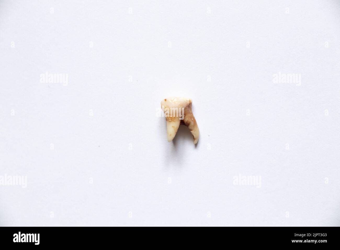 baby milk tooth pulled out lies on a white background, dentistry and ...