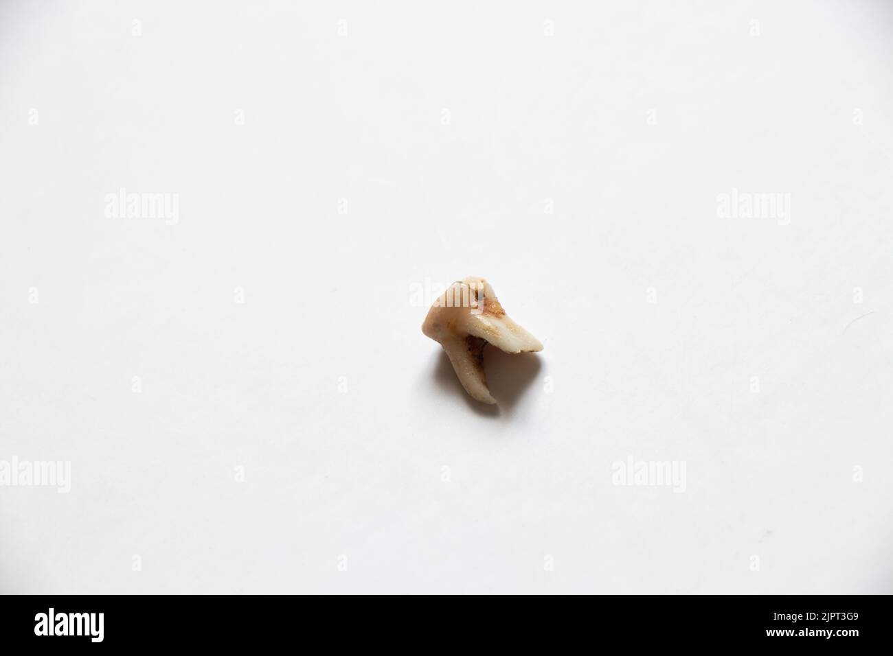 Pulled out baby tooth on hi-res stock photography and images - Alamy