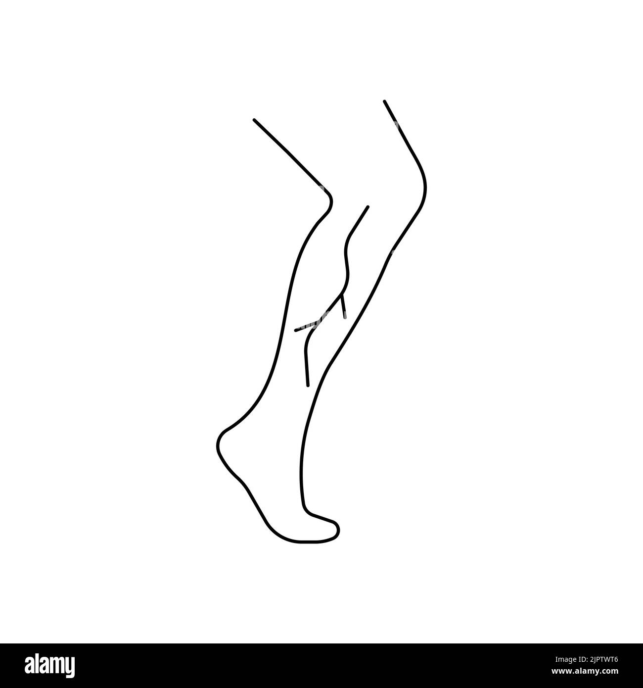 Varicose veins icon. Vascular mesh on the legs. Venous disease. Vector ...