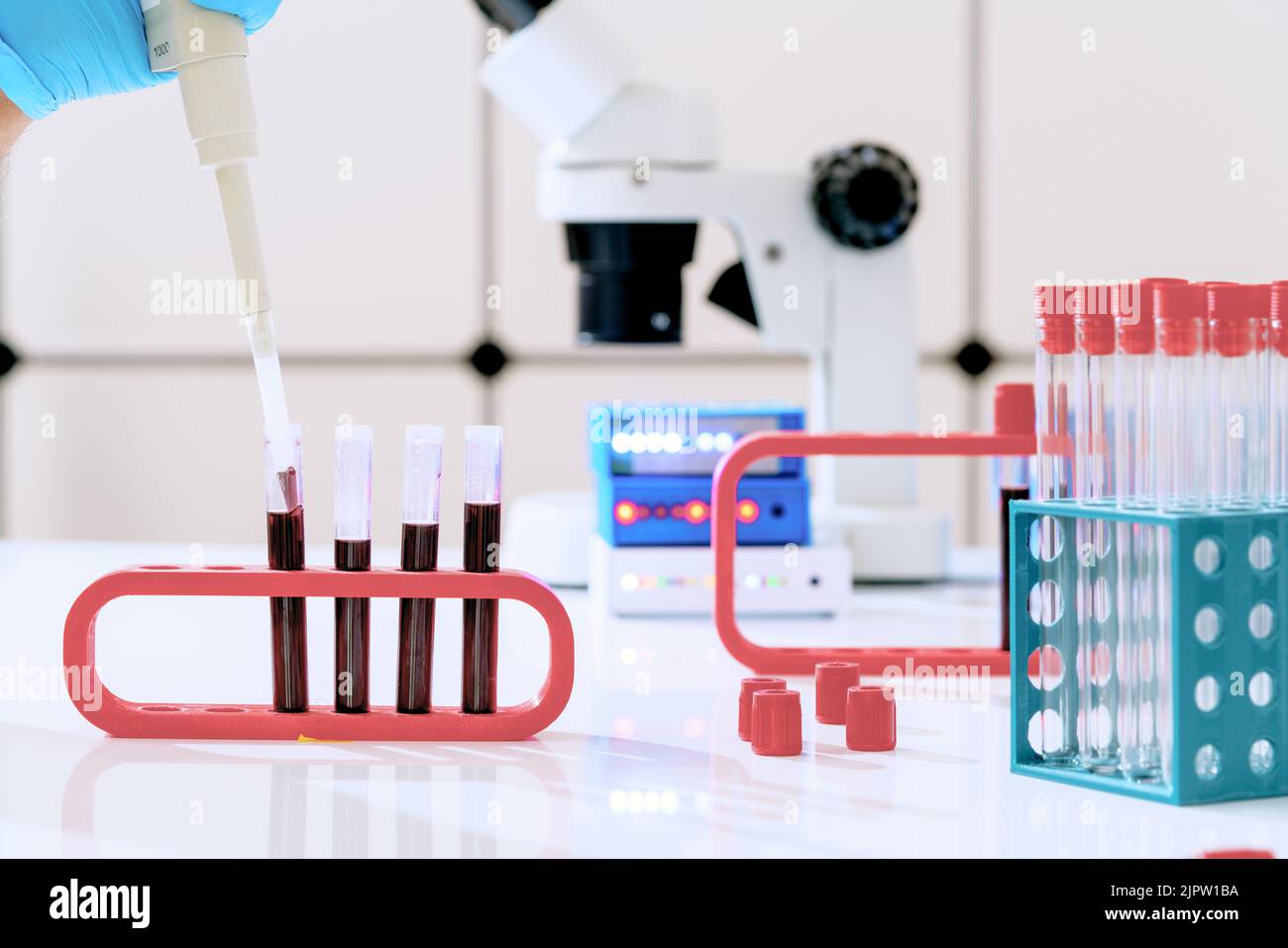 Blood test for hormones and microelements in a biochemical laboratory ...