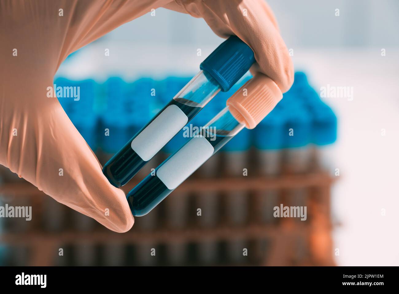 test tubes with a dark blue liquid in the hands of laboratory ...