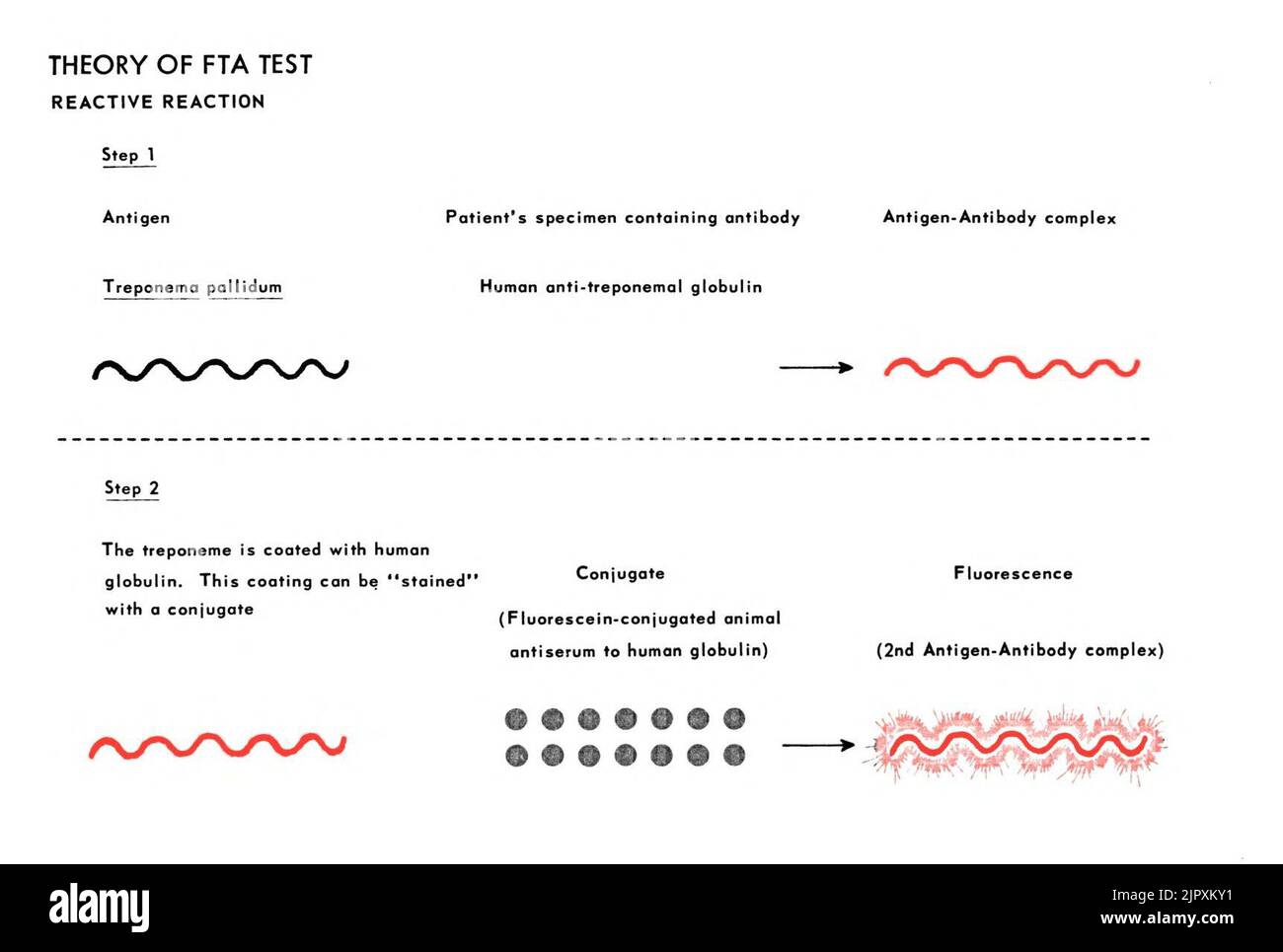 Theory of FTA Test - Reactive Reaction Stock Photo - Alamy