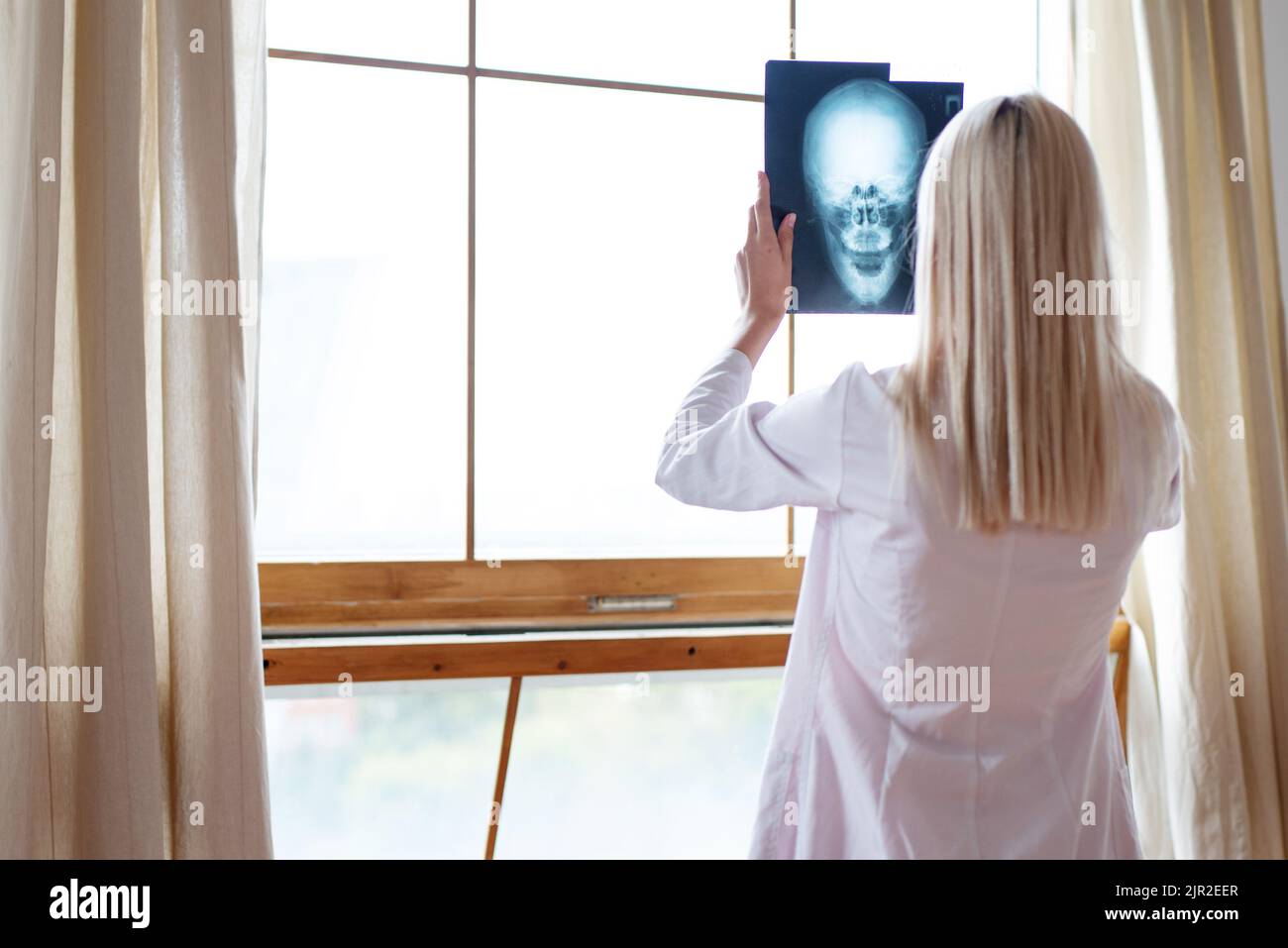 Female doctor examines x-ray of patients skull Stock Photo - Alamy