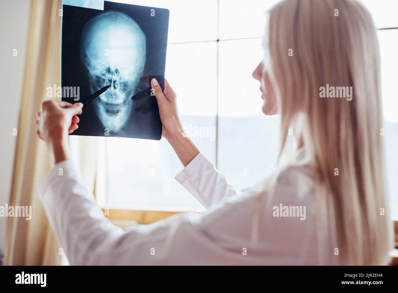 Female doctor examines x-ray of patients skull Stock Photo - Alamy