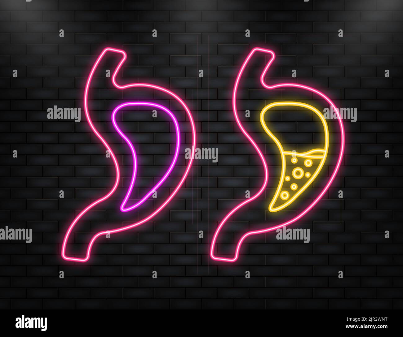 Human stomach. Healthy and unhealthy. Digestive system anatomy. Vector ...