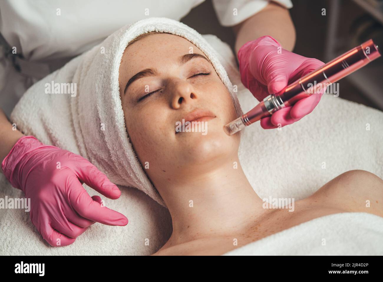 Woman getting facial treatment of chin zone with derma pen at spa salon ...