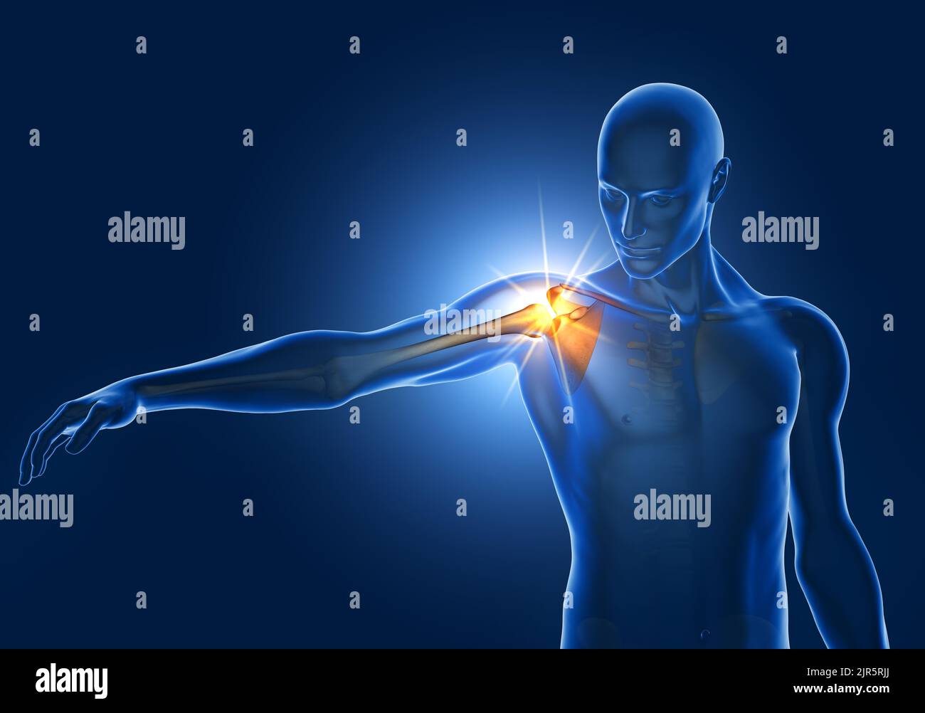 Illustration showing shoulder impingement, painfull arc, 3D ...