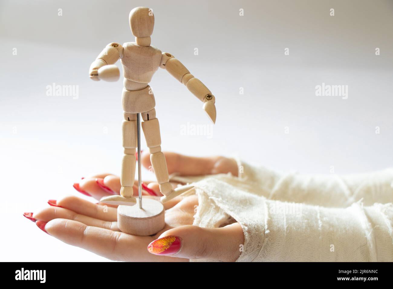 two female hands with broken wrists after falling from a bicycle in a ...