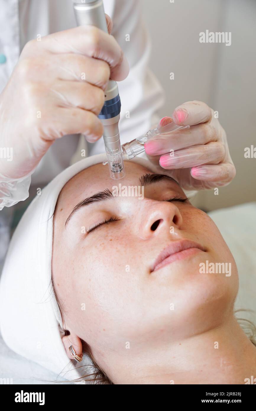 Microneedles for collagen induction therapy. Microneedle RF lifting ...