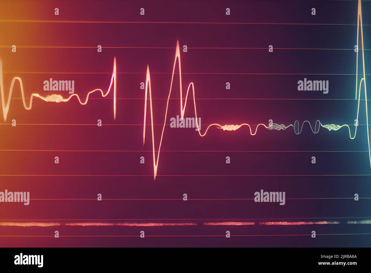 Electrocardiogram, EKG, heart rate monitor showing a specific illness ...
