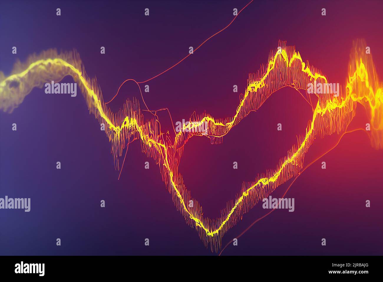 Electrocardiogram, EKG, heart rate monitor showing a specific illness ...
