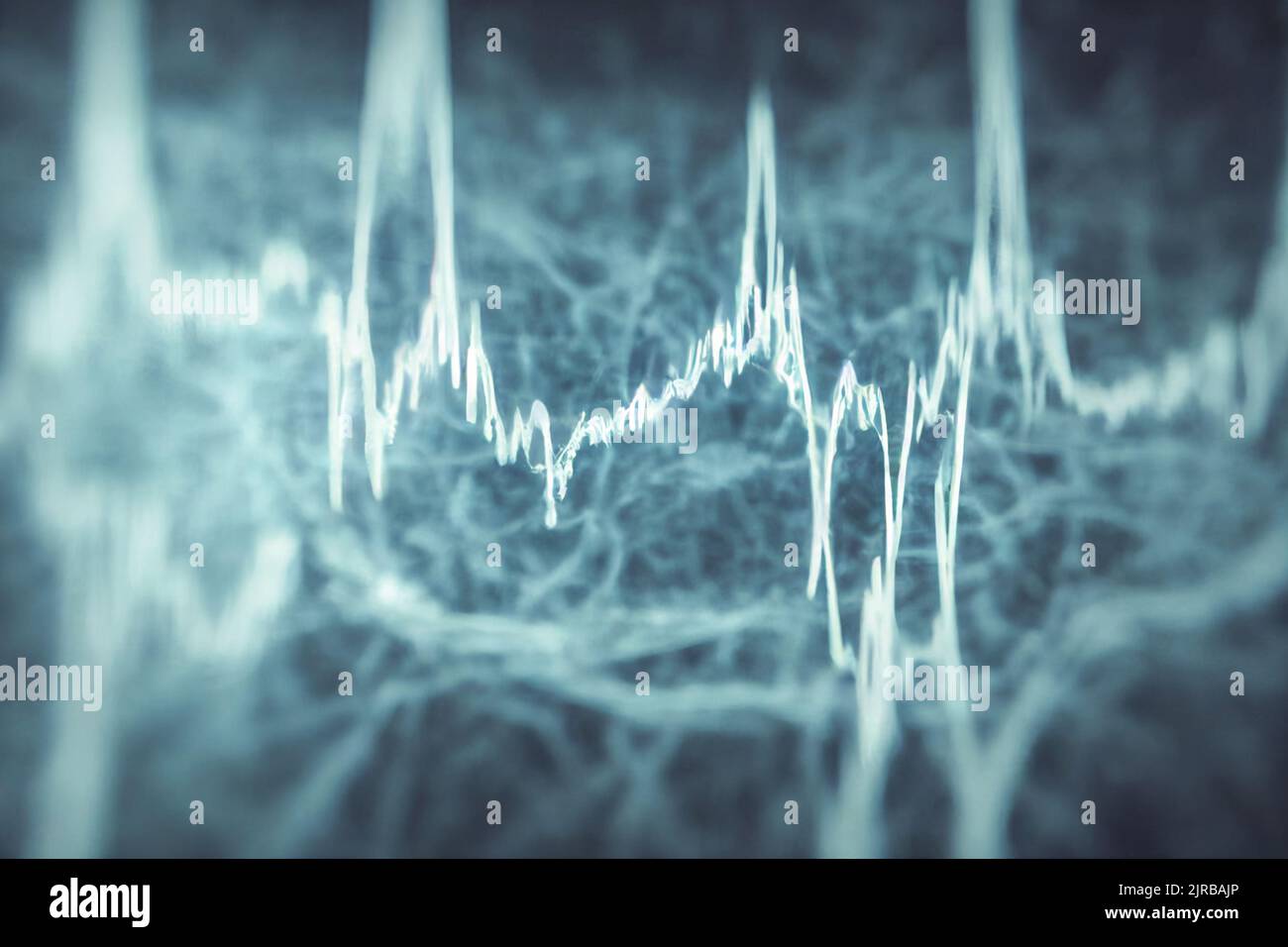 Electrocardiogram, EKG, heart rate monitor showing a specific illness ...
