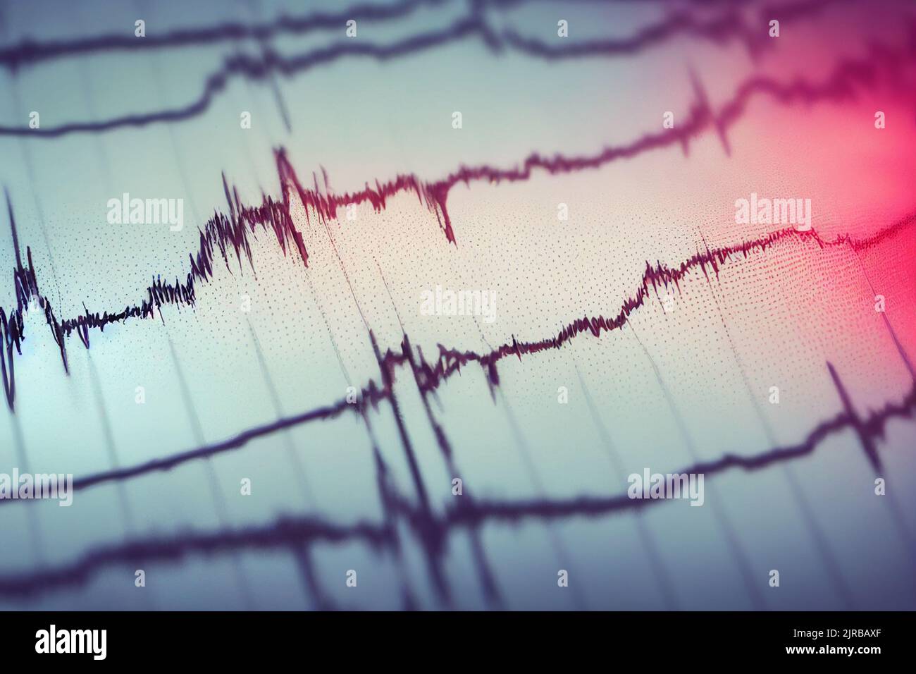 Electrocardiogram, EKG, heart rate monitor showing a specific illness ...