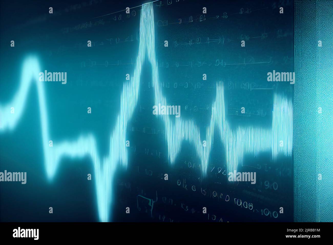 Electrocardiogram, EKG, heart rate monitor showing a specific illness ...