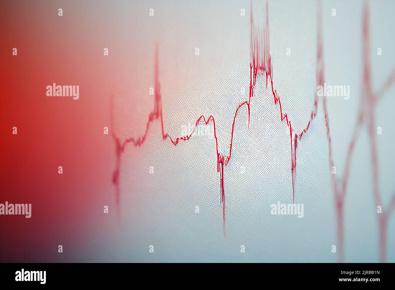 Electrocardiogram, EKG, heart rate monitor showing a specific illness ...