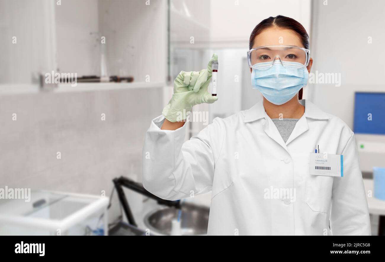 asian female doctor holding beaker with blood test Stock Photo - Alamy