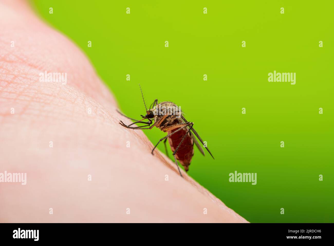 Dangerous Zika Infected Mosquito Skin Bite. Leishmaniasis, Encephalitis ...
