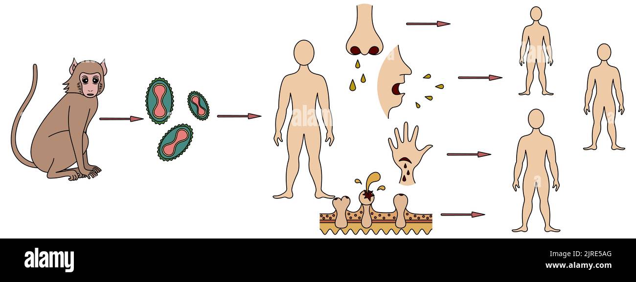 Scheme of infection and ways of transmission to humans of the monkeypox ...