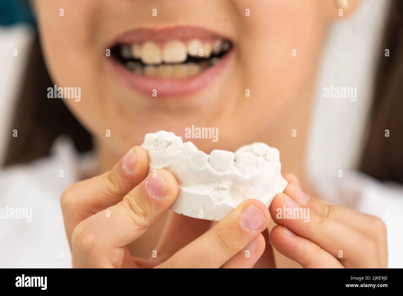 little girl with plaster cast of teeth and with the metal apparatus on ...