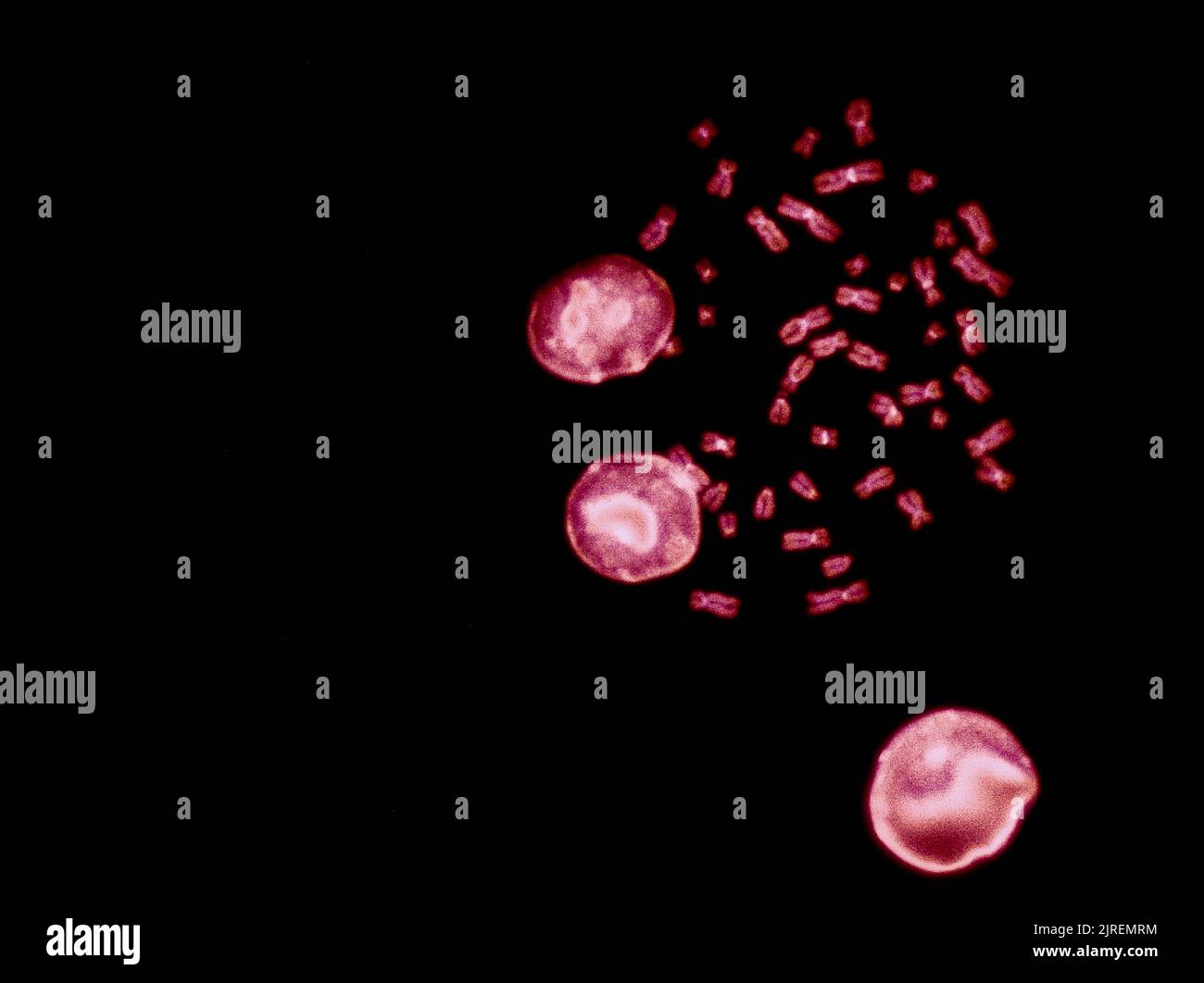 Chromosomes under fluorescence microscope, red colored Human ...
