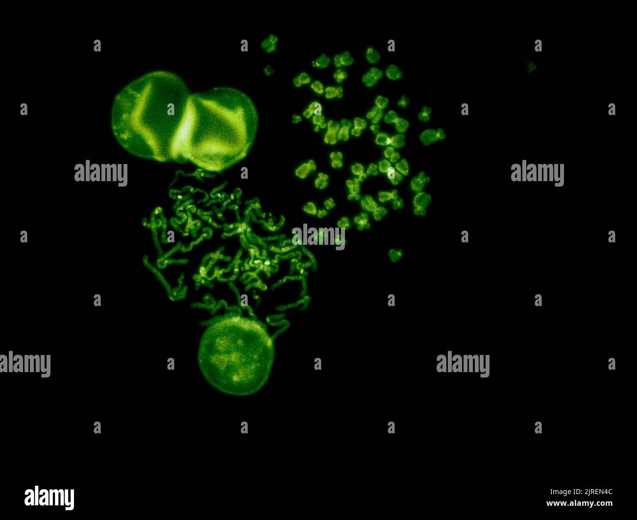 Chromosomes under fluorescence microscope, green colored Human ...