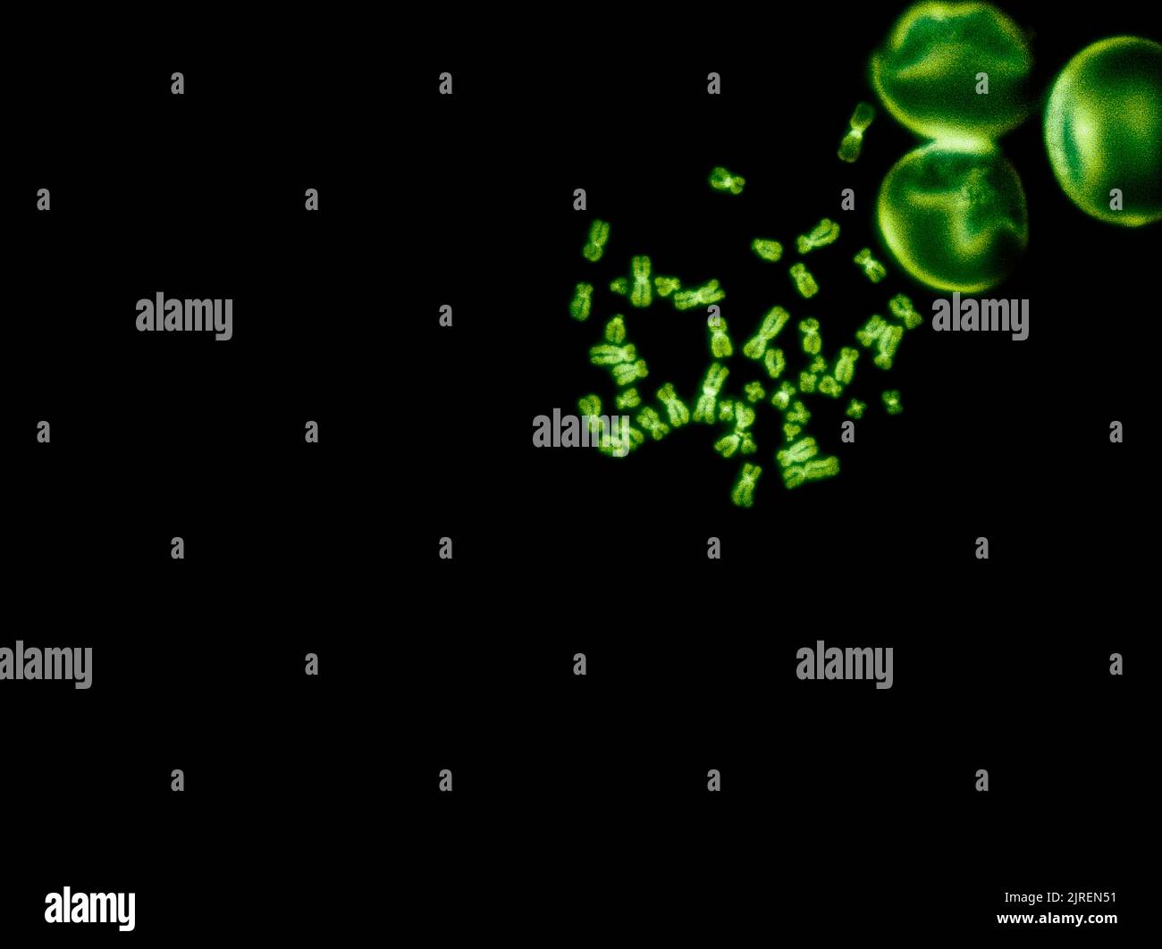 Chromosomes under fluorescence microscope, green colored Human ...