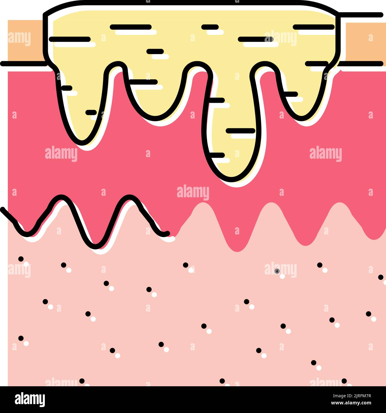 hyperpigmentation acne scar color icon vector illustration Stock Vector ...