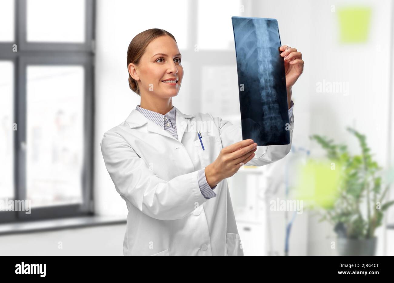 female doctor with x-ray of spine at hospital Stock Photo - Alamy