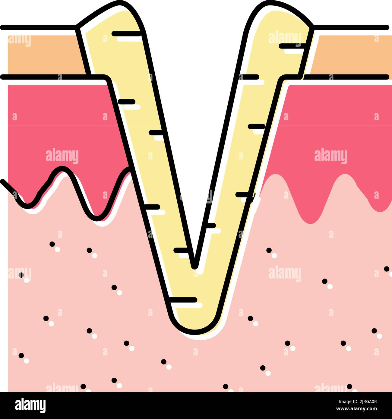 Pitted ice Stock Vector Images - Alamy