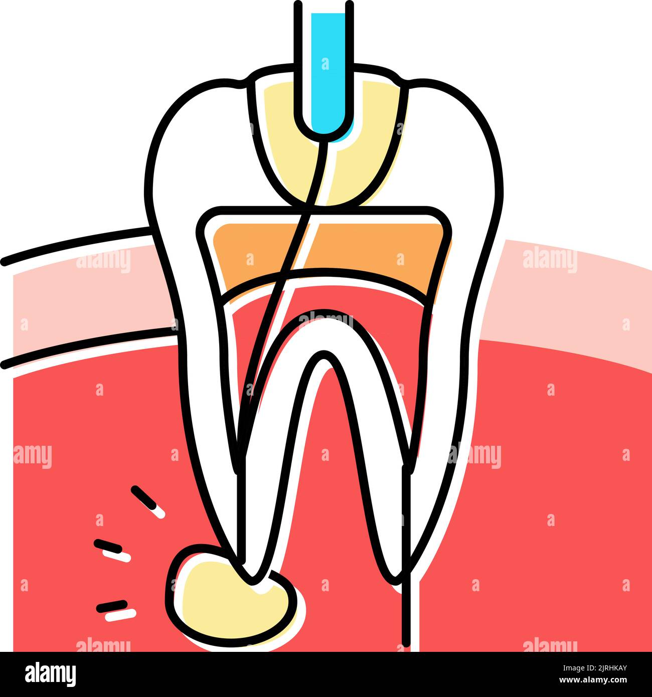 root canal treatment color icon vector illustration Stock Vector Image ...