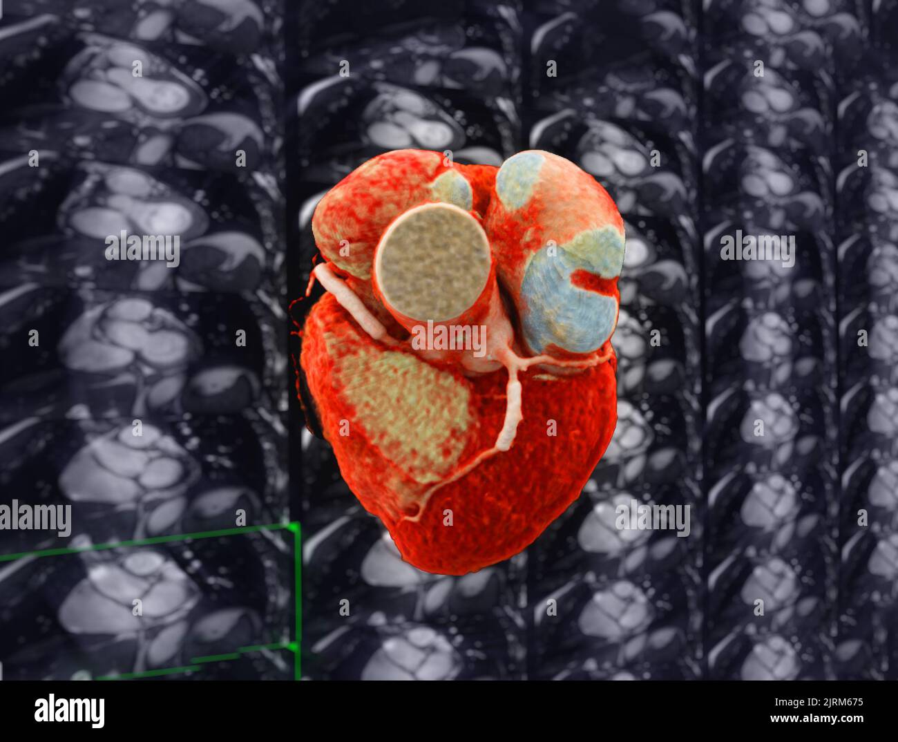 3D heart on blurred mri heart background Stock Photo - Alamy