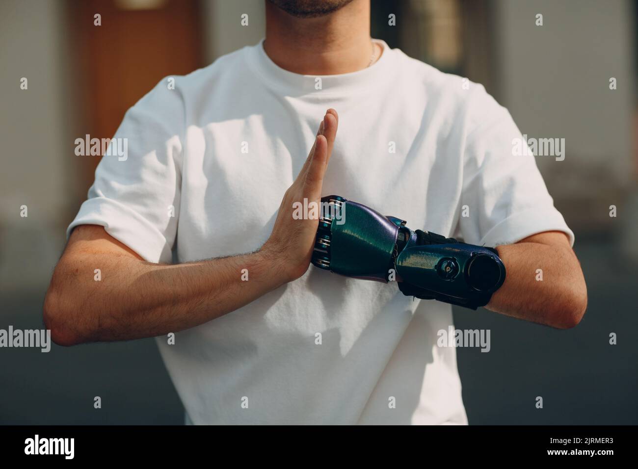 Young disabled man with artificial prosthetic hand doing yoga asana in ...