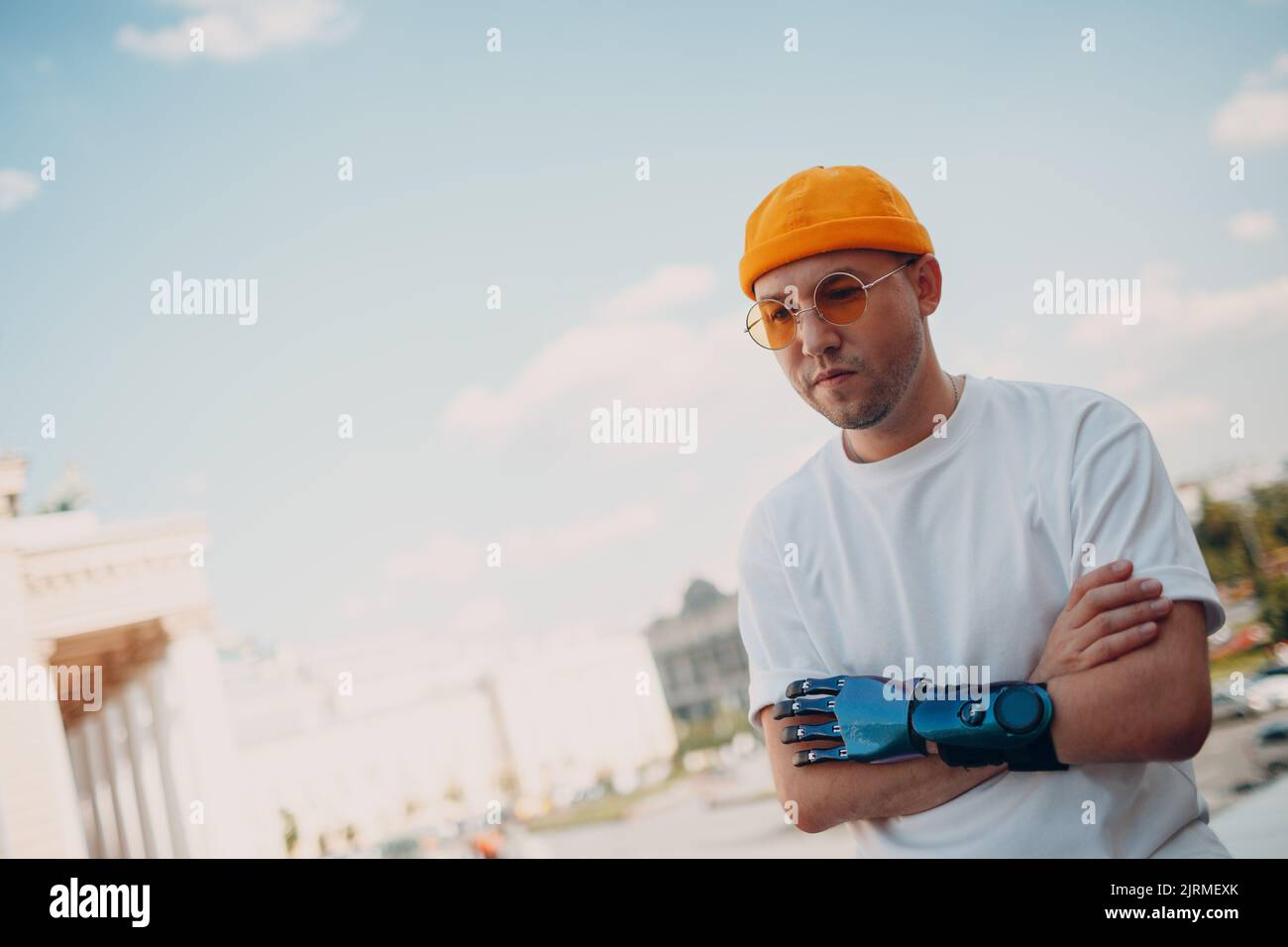 Young disabled man with artificial prosthetic hand in casual clothes ...