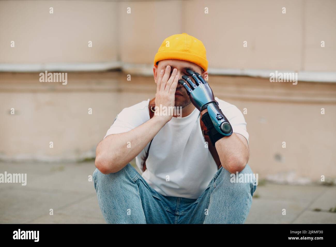 Young disabled upset sad man with artificial prosthetic hand close his ...