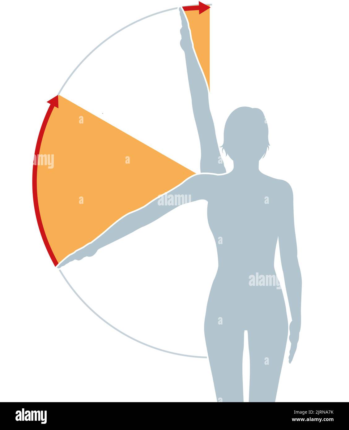 Illustration showing shoulder impingement syndrome and painful arc ...