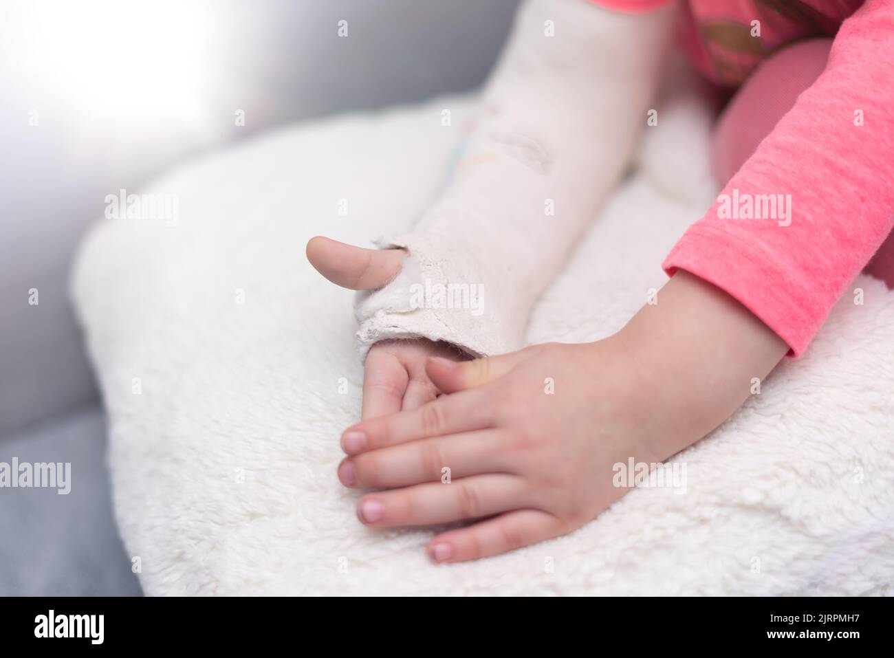 Broken upper arm bone hi-res stock photography and images - Alamy