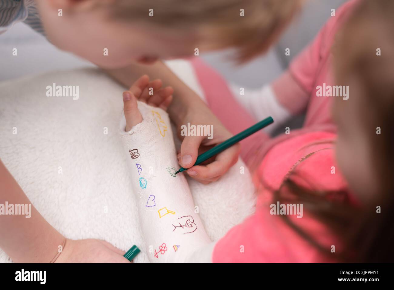 River fracture in a child. Brother and sister draw on plaster, bandages ...