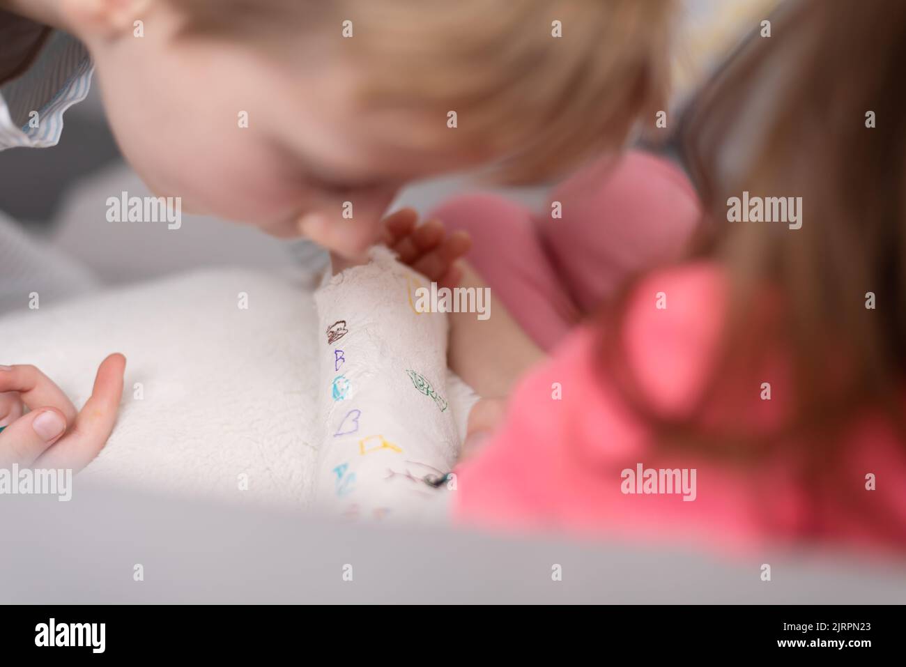 River fracture in a child. Brother and sister draw on plaster, bandages ...