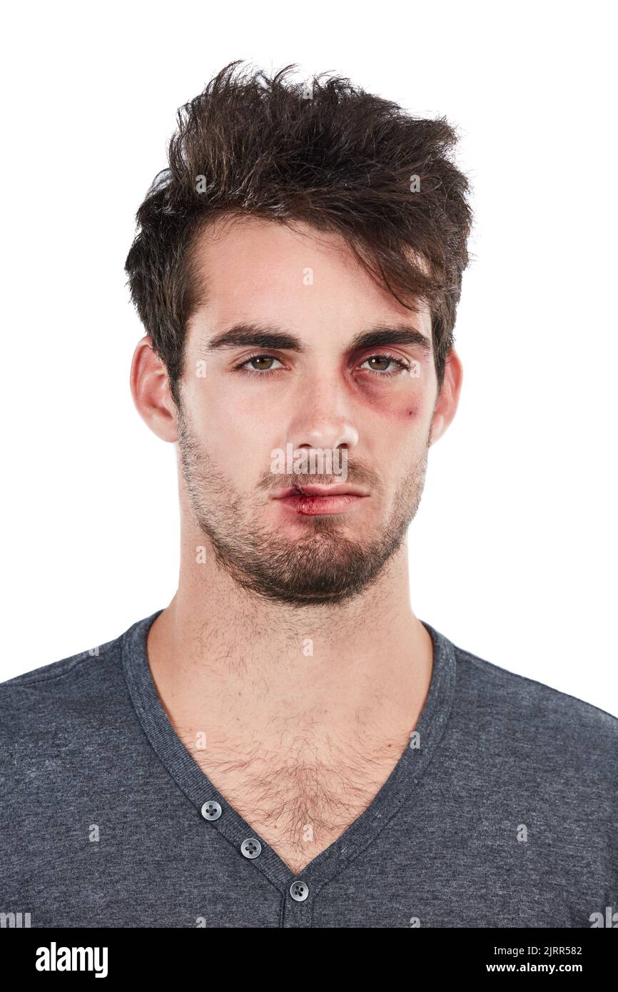 Man with scratches on his back hi-res stock photography and images - Alamy